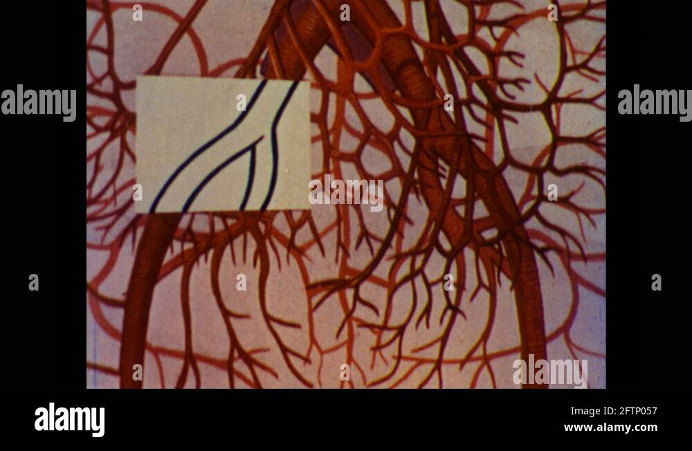 1960s: close up animation of blood vessel. Drawing of blood vessel ...