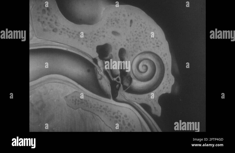UNITED STATES, 1930s: Diagram showing the ear bones or ossicles. Close ...