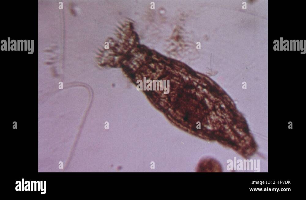 UNITED STATES: 1940s: Rotifer on a microscope slide Stock Video Footage ...