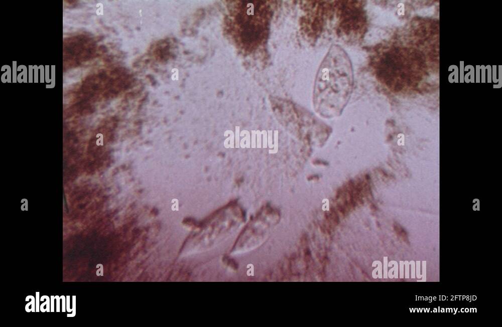 UNITED STATES: 1940s: Microscopic vorticella on a microscope slide ...