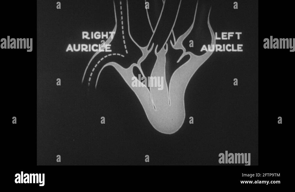Left ventricle Stock Videos & Footage - HD and 4K Video Clips - Alamy