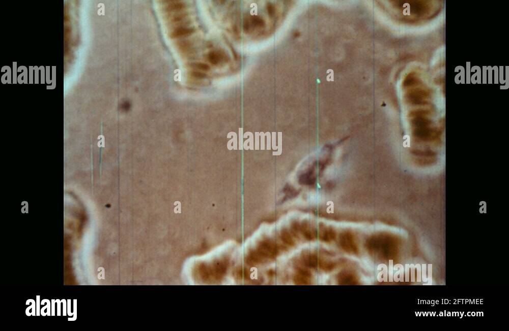 UNITED STATES 1950s: Magnified view of white blood cells Stock Video ...