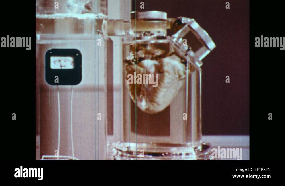 Health heart 1950s Stock Videos & Footage - HD and 4K Video Clips - Alamy