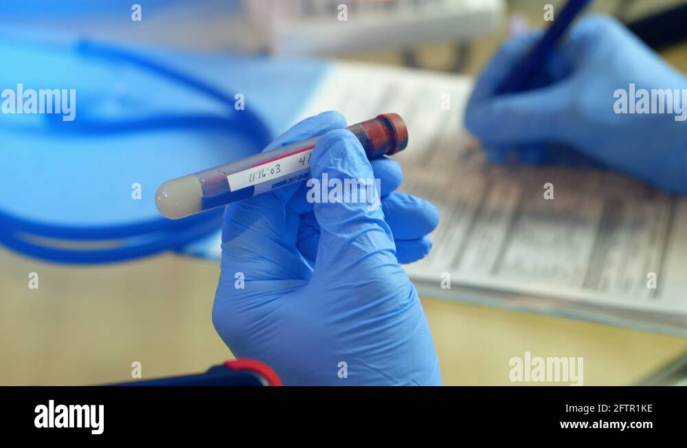 Tube vacutainer Stock Videos & Footage - HD and 4K Video Clips - Alamy