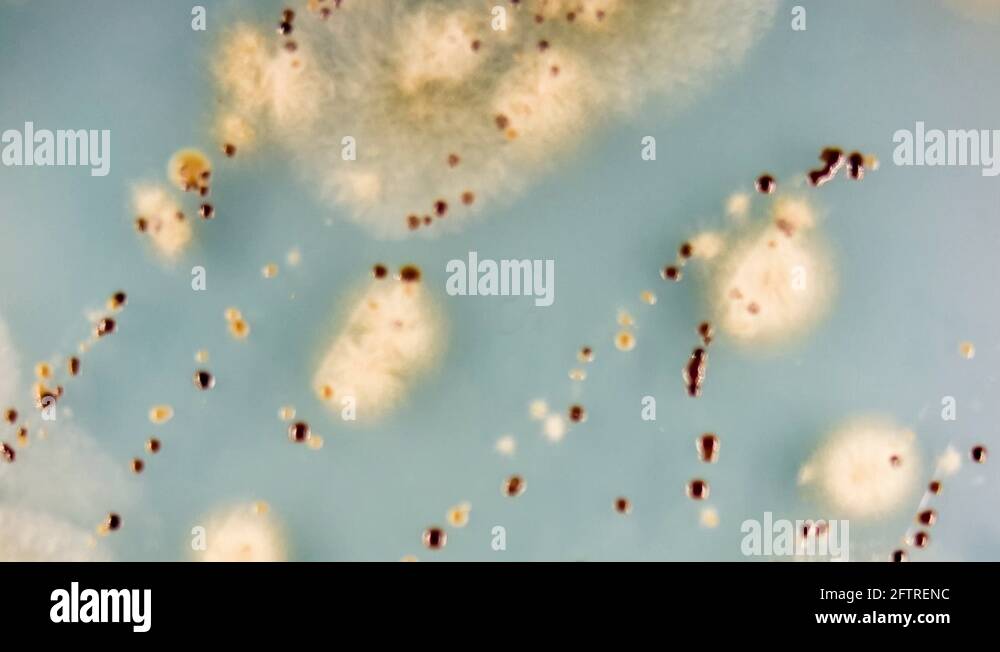 Petri dish colonies pathogenic bacteria Stock Videos & Footage - HD and 4K Video Clips - Alamy