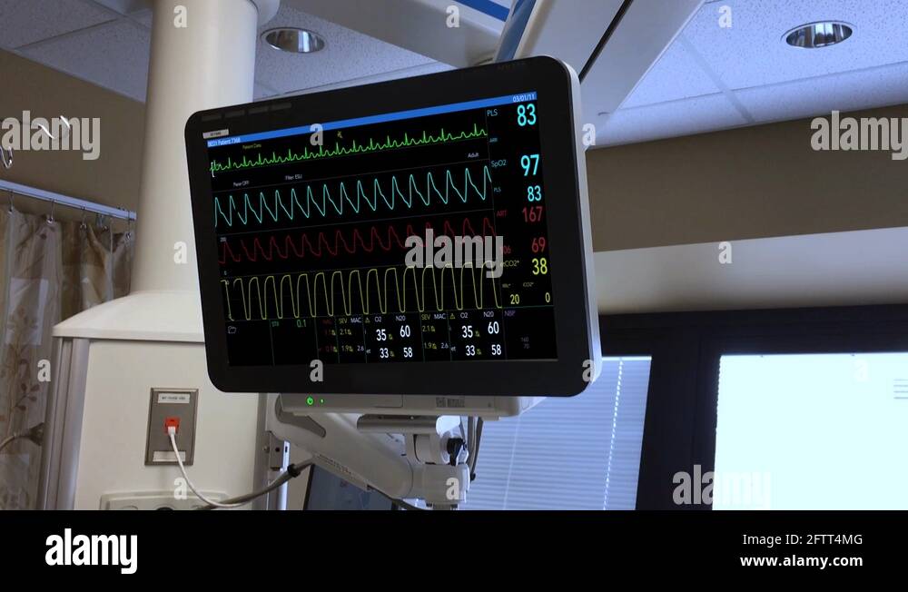 Hospital chart heart monitor Stock Videos & Footage - HD and 4K Video ...