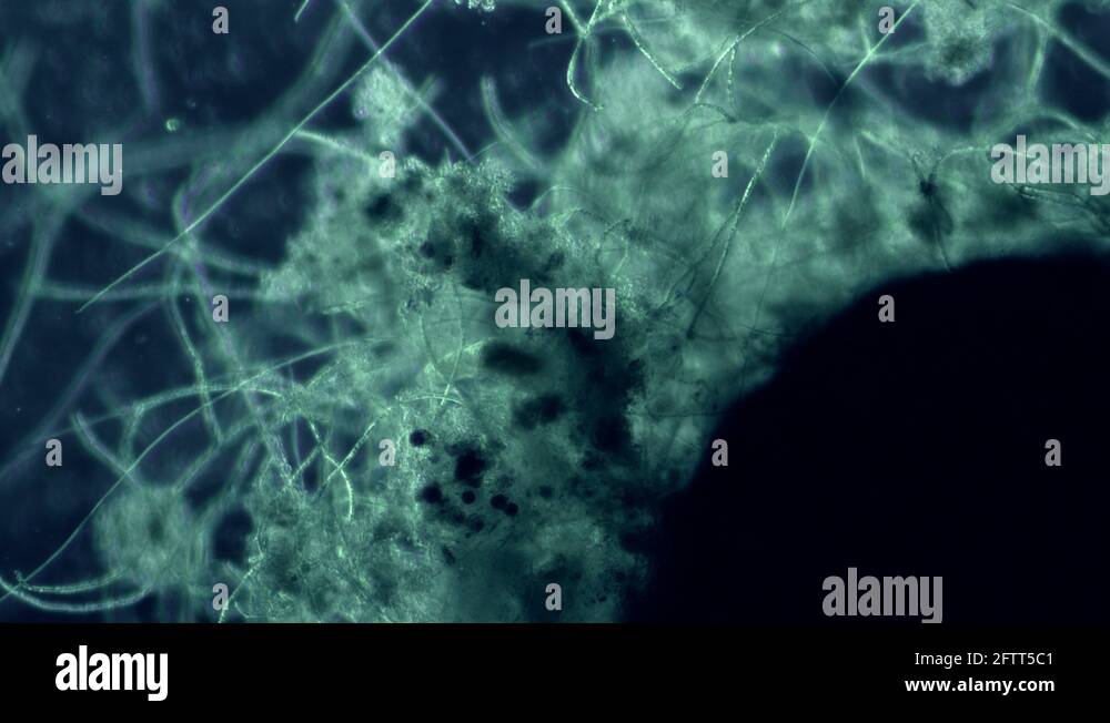 Parasites microscope Stock Videos & Footage - HD and 4K Video Clips - Alamy