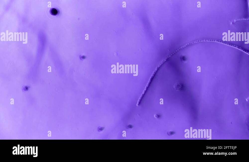 Dancing Protozoa From Lake Water Sample Time Lapse 400x Phase ...