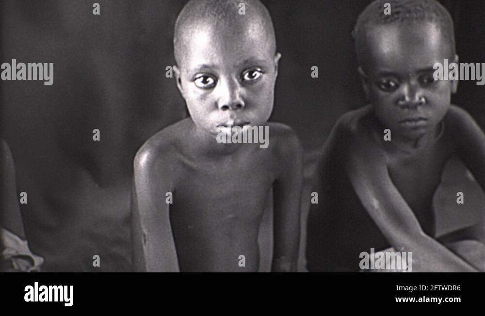 Starving African Kids Face Children Famine Starvation 1950s Vintage ...