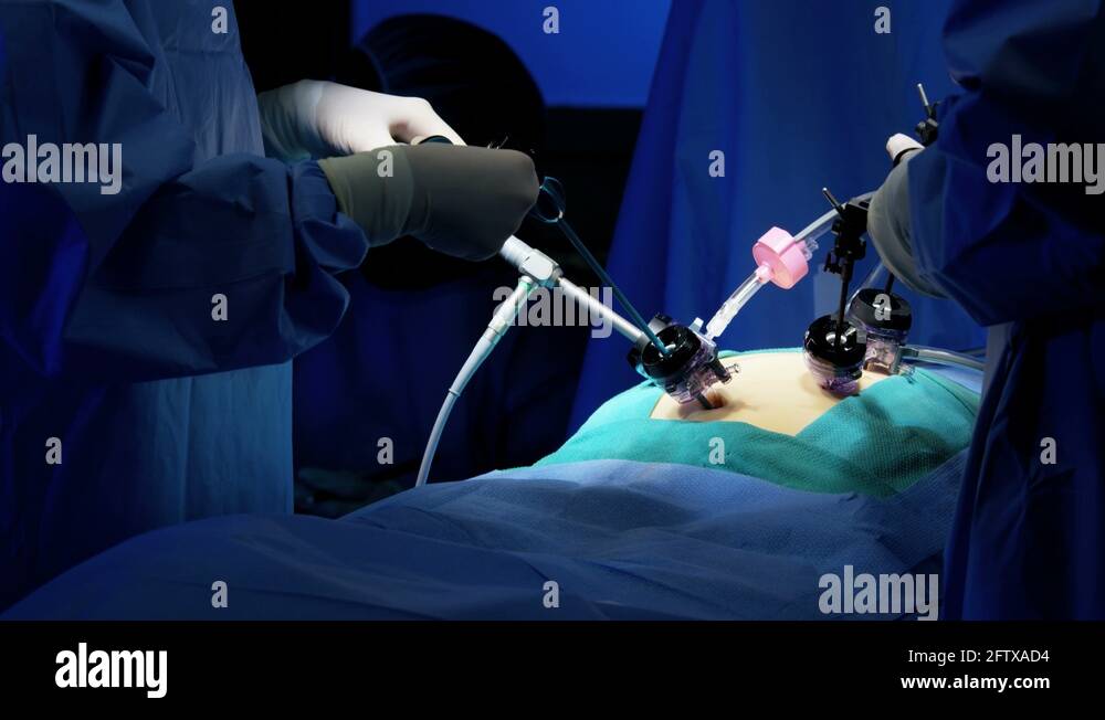 Hospital theatre operation Stock Videos & Footage - HD and 4K Video ...