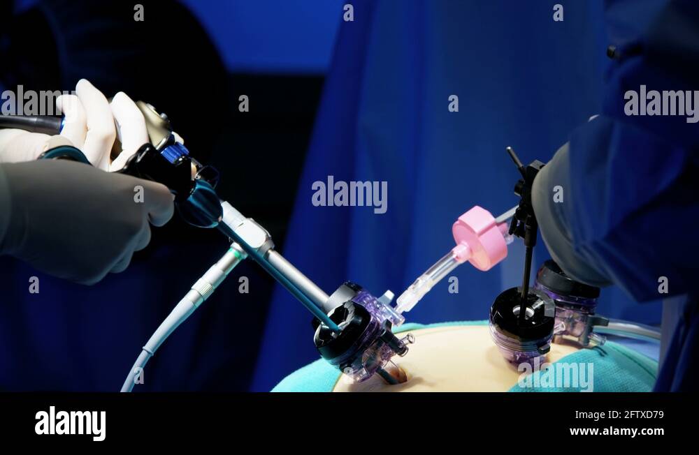 Laparoscopic surgical operation in hospital theatre using Endoscopy and ...