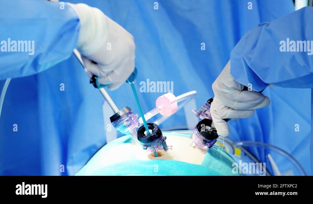 Laparoscopic surgical operation transmitted on hospital monitors ...