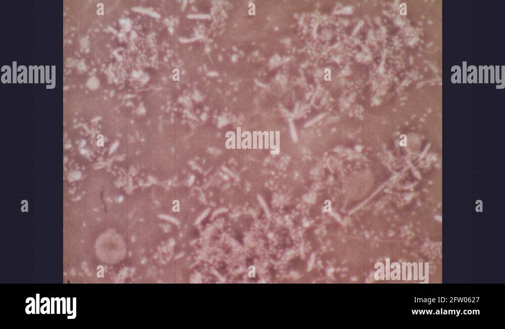 Microscopic teeth Stock Videos & Footage - HD and 4K Video Clips - Alamy