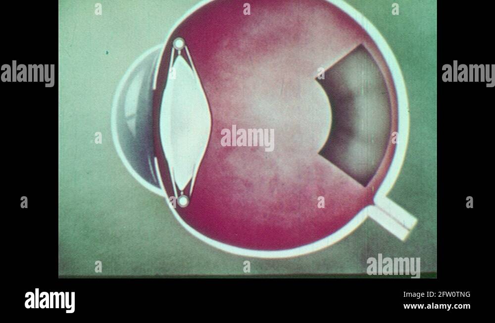 1950s: Chart and animation: side view of eye, muscle contracting to ...