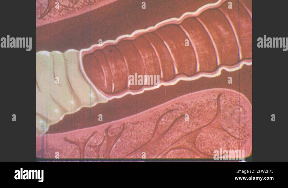 1970s: Illustration of trachea. Animation of cilia moving inside ...
