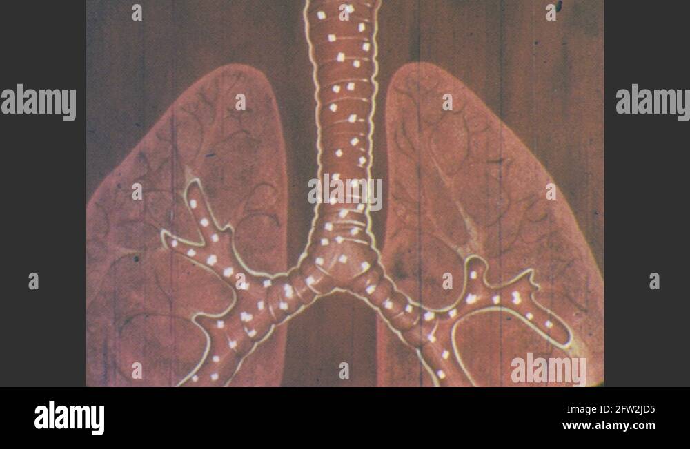 Bronchial tubes Stock Videos & Footage - HD and 4K Video Clips - Alamy