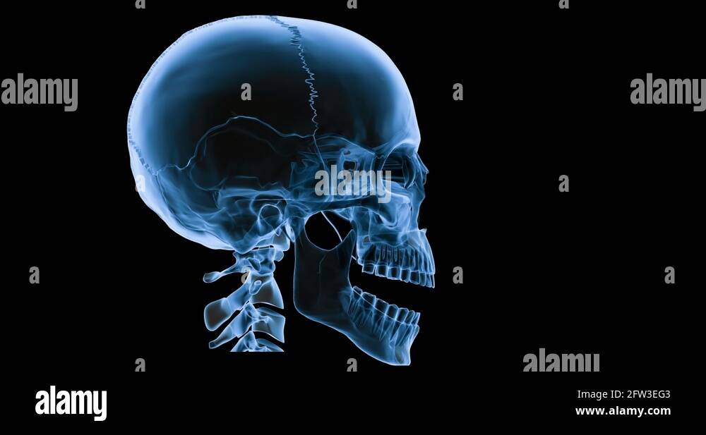 Human skull x ray side view Stock Videos & Footage - HD and 4K Video ...