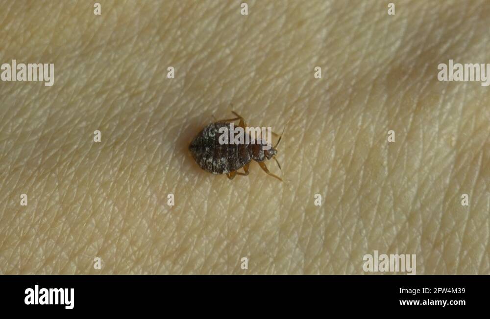 Insect macro 4k: Common bedbug parasite on human skin in bed at night ...
