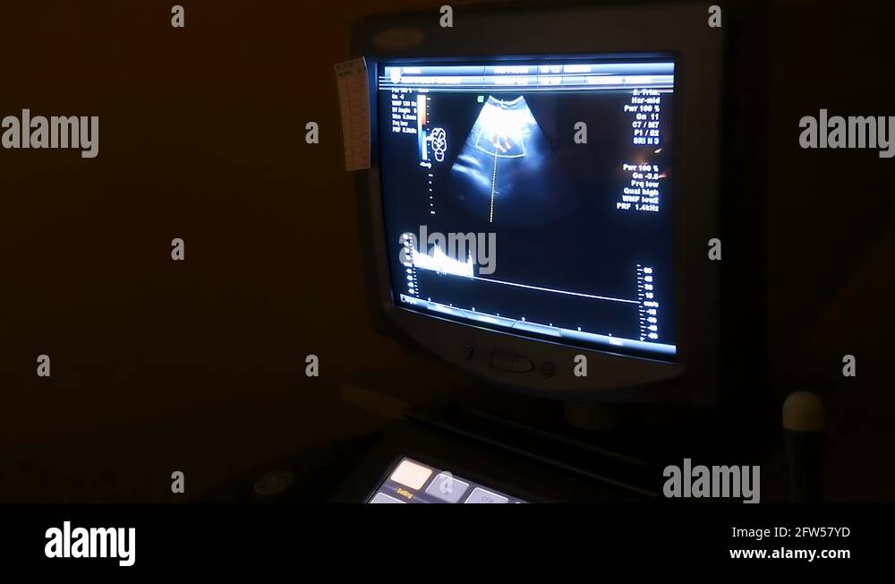 Gynecologist using ultrasound machine Stock Videos & Footage - HD and ...
