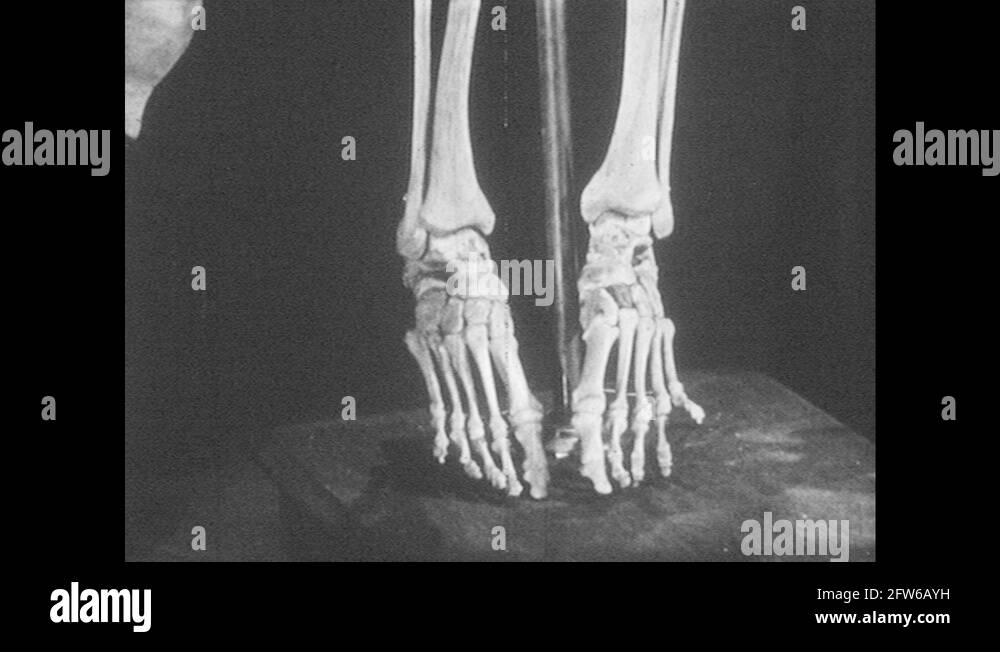 1950s: Man gestures to ankles and feet of model skeleton, moves feet ...