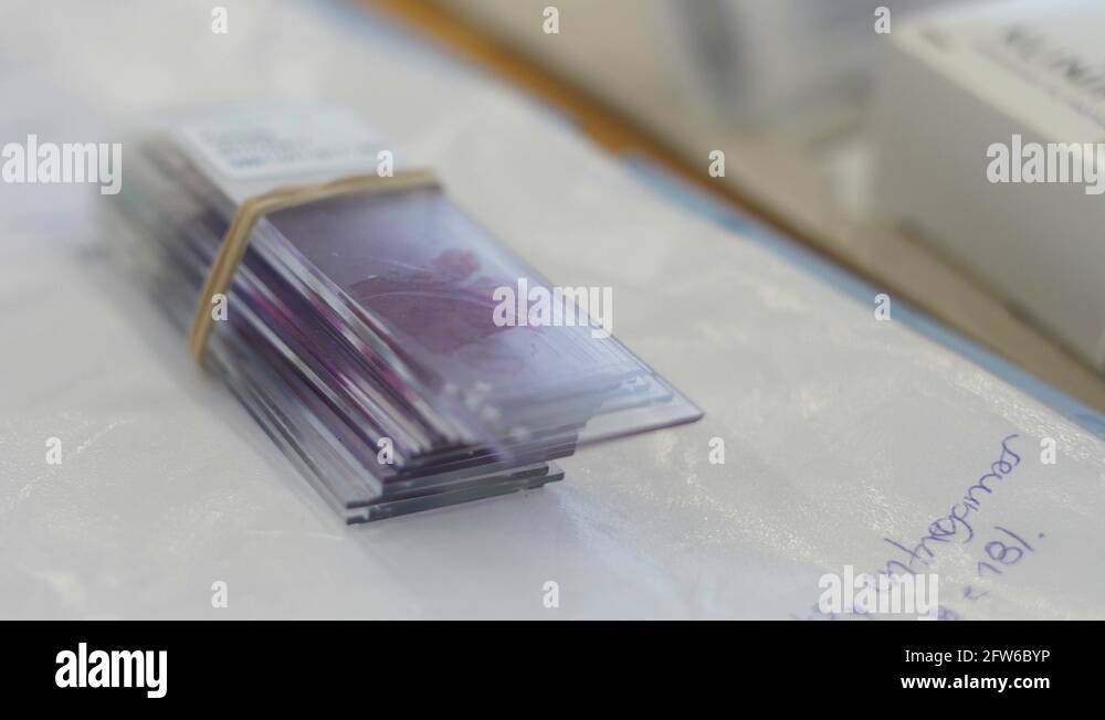 Laboratory microscope slide Stock Videos & Footage - HD and 4K Video ...