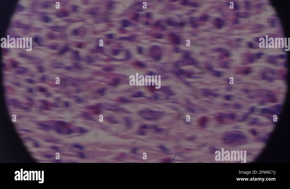 cells seen through a microscope 4k Stock Video Footage - Alamy