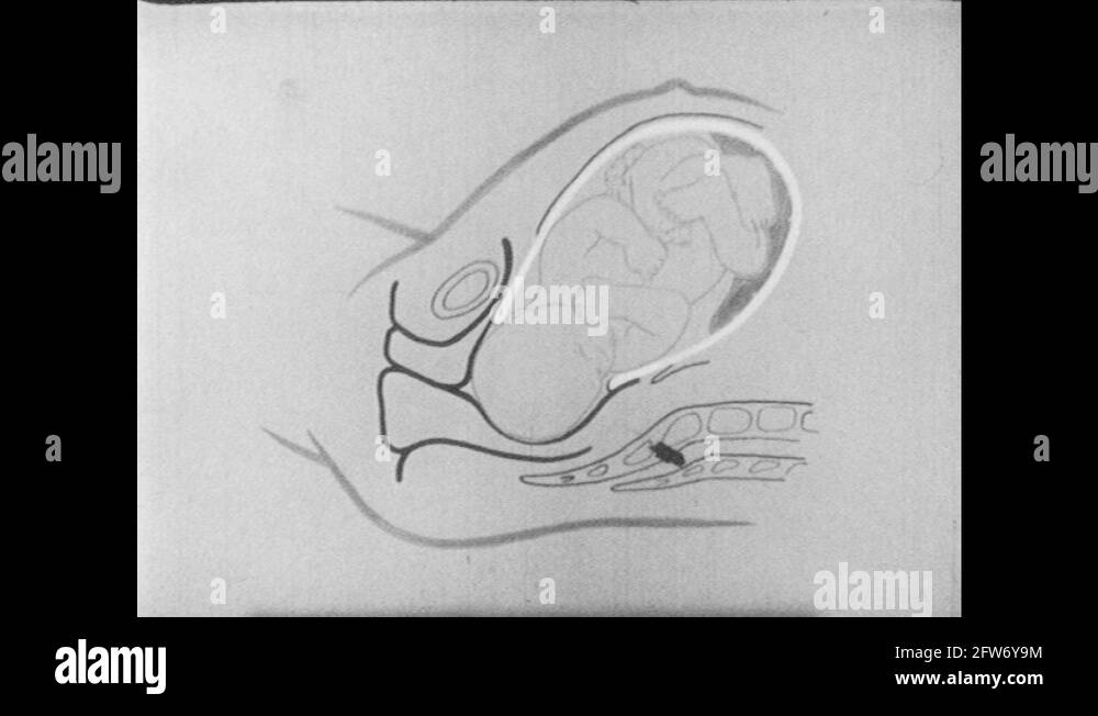 1950s: UNITED STATES: diagram of baby inside birth canal. Vagina view ...