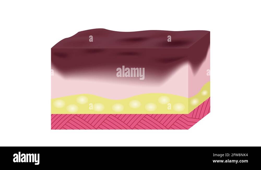 Human skin diagram normal Stock Videos & Footage - HD and 4K Video ...