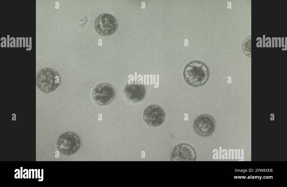 1940s: Under microscope, hatched tapeworm embryos (coracidia) begin to ...