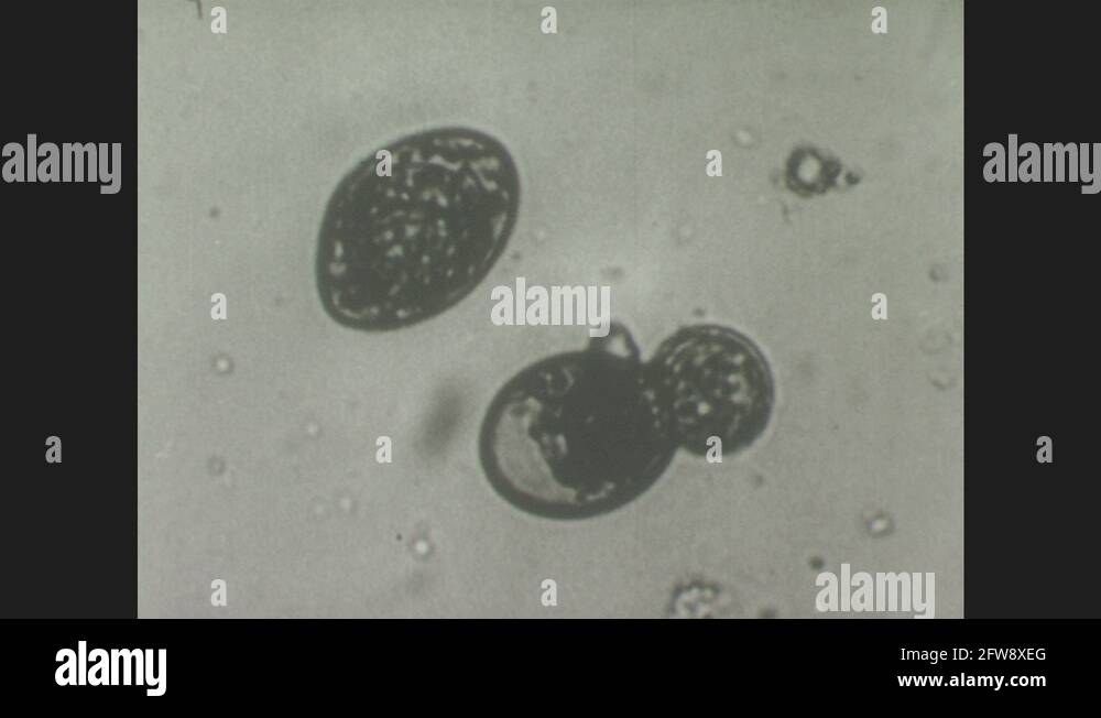 1940s: Tapeworm egg under microscope hatches, operculum opens, hatched ...