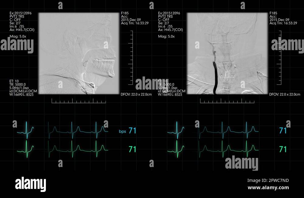 Neuro imaging Stock Videos & Footage - HD and 4K Video Clips - Alamy
