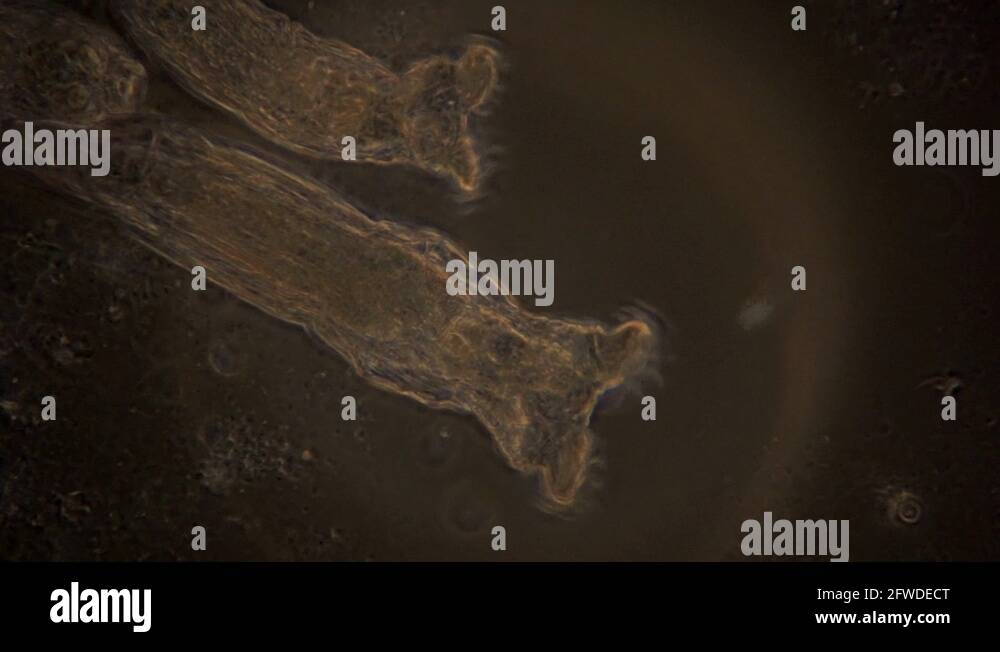 Micro contrast Stock Videos & Footage - HD and 4K Video Clips - Alamy