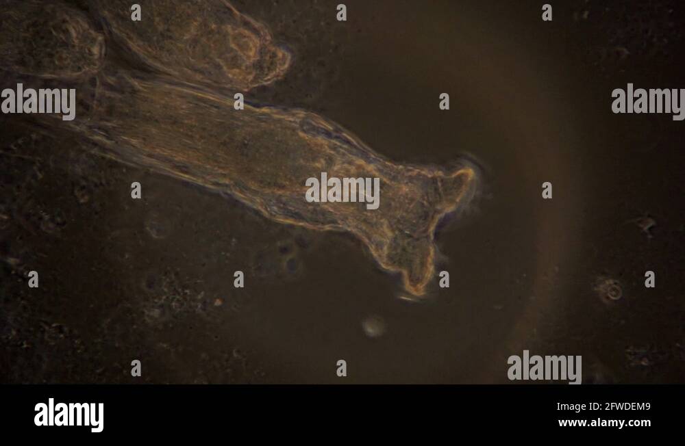 Freshwater rotifers Stock Videos & Footage - HD and 4K Video Clips - Alamy
