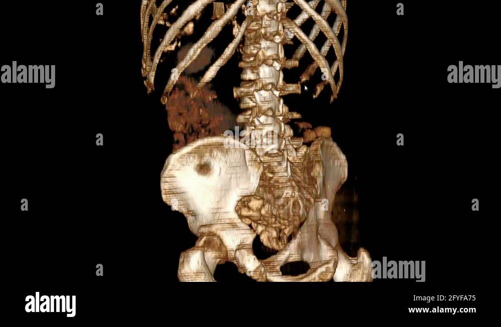 Skeleton in 3d Stock Videos & Footage - HD and 4K Video Clips - Alamy