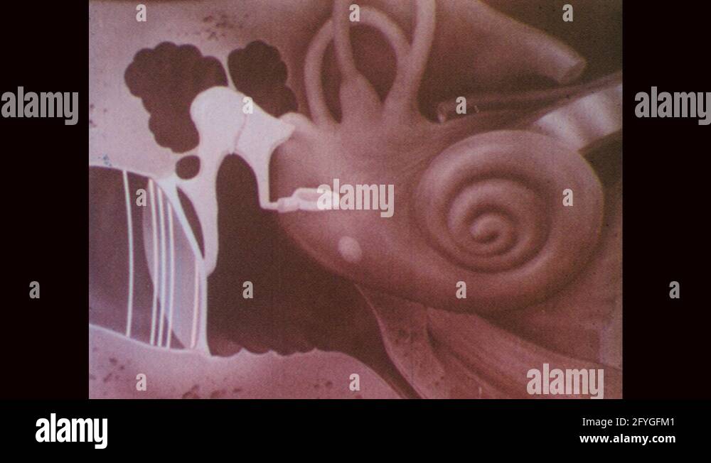 1960s: Animated cross-section of inner ear. Animated ear drum and bones ...
