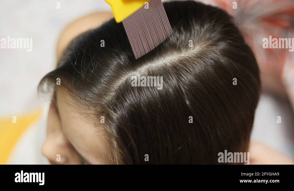 Hair lice Stock Videos & Footage - HD and 4K Video Clips - Alamy