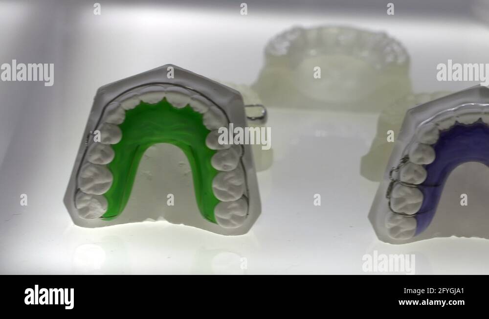 3d printed teeth Stock Videos & Footage - HD and 4K Video Clips - Alamy