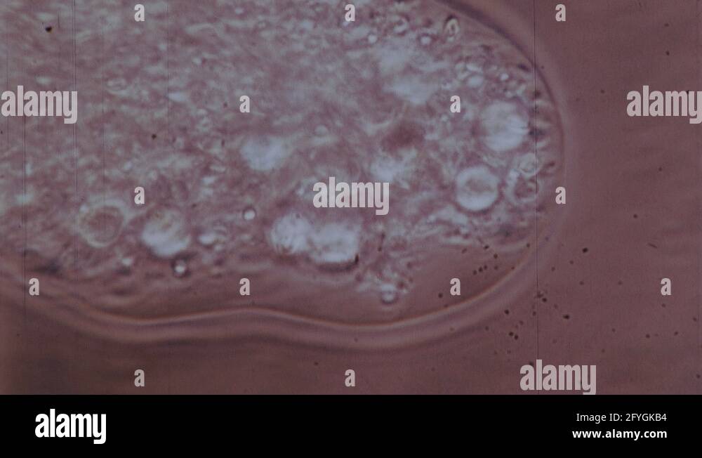 Amoeba Microscopic Microscope Cell Microorganism Biology Vintage 16mm ...