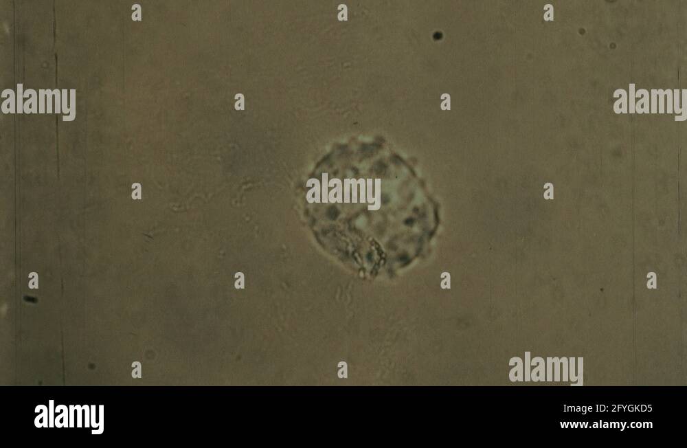 Amoeba Microscopic Life Reproduction Cell Splits Biology Vintage Film ...
