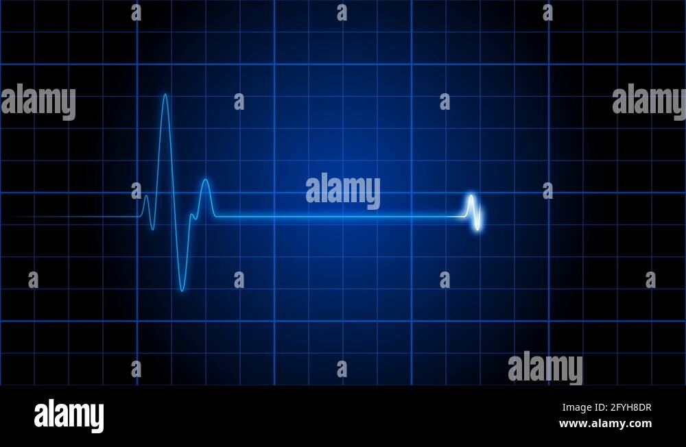 An Electrocardiogram EKG Heart Monitor Pulses on a Blue Grid Stock ...