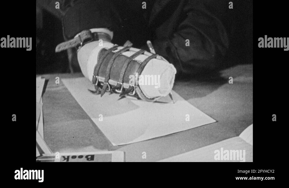 1940s: Man with amputated hand writes with pencil using prosthetic ...