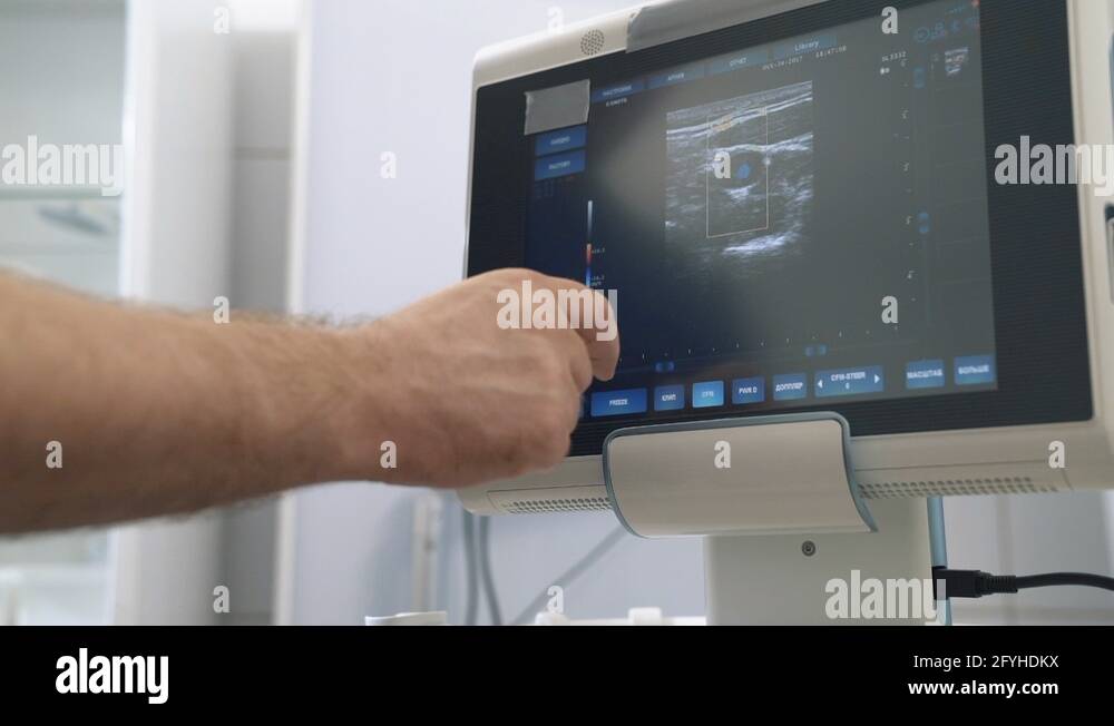 Ultrasound of human internal organs Stock Videos & Footage - HD and 4K ...