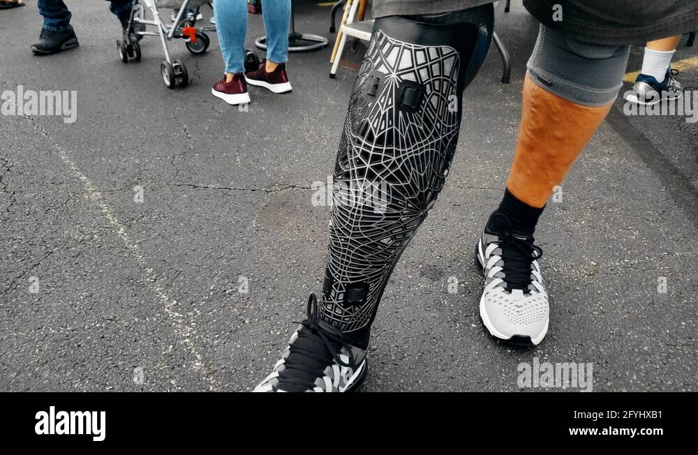 3d printed prosthetic limb Stock Videos & Footage - HD and 4K Video ...