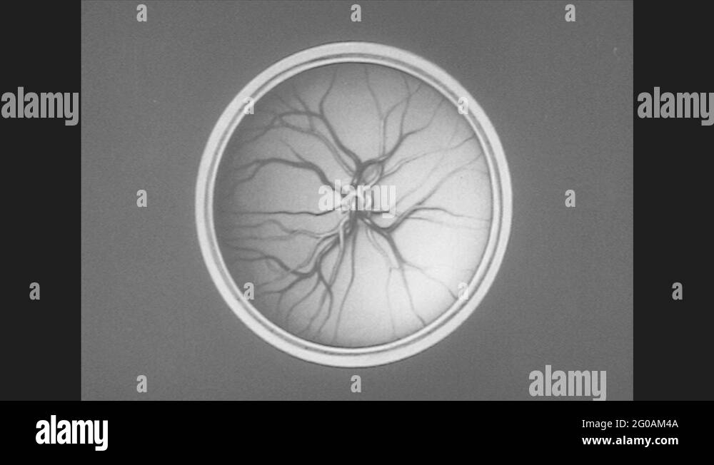 1940s: Animated diagram of a human eyeball. Veins in eyeball. Diagram ...