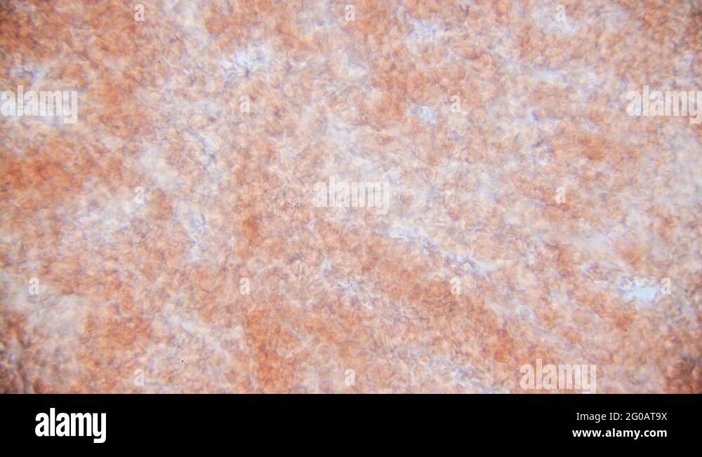 Red cells under microscope Stock Videos & Footage - HD and 4K Video ...