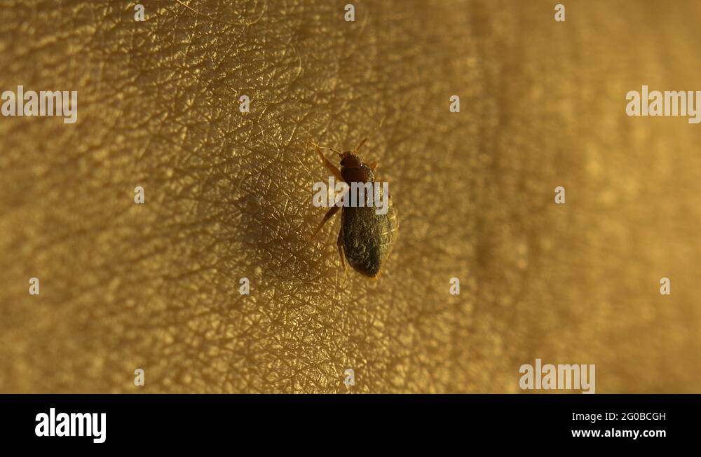 Insect macro 4k: Common bedbug parasite on human skin in bed at night ...