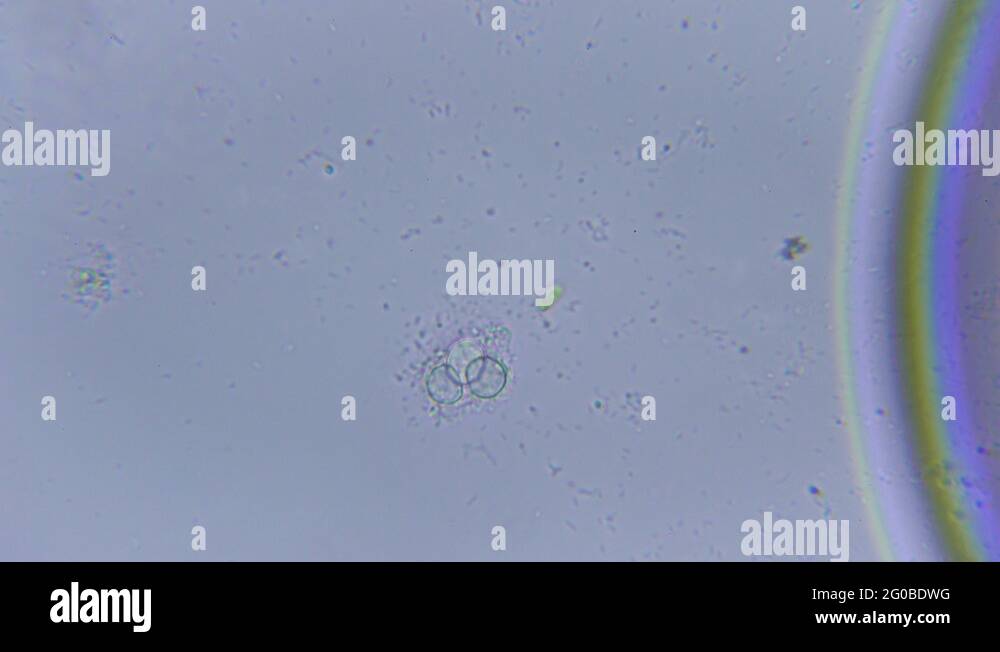 Bright field microscope Stock Videos & Footage - HD and 4K Video Clips ...