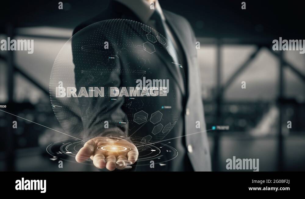 Boxing brain Stock Videos & Footage - HD and 4K Video Clips - Alamy