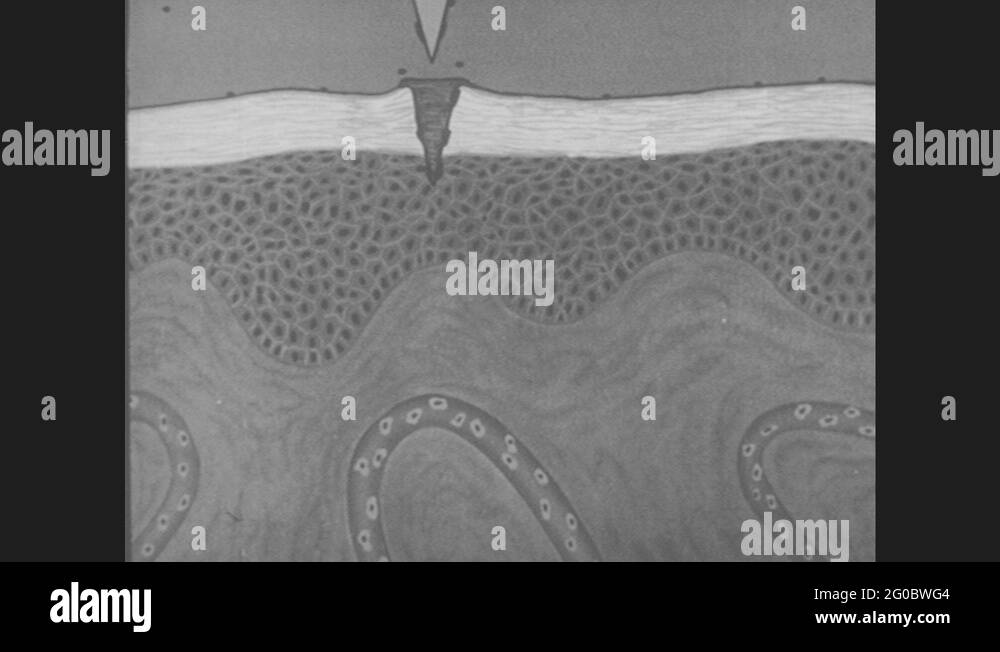 Skin damage diagram Stock Videos & Footage - HD and 4K Video Clips - Alamy