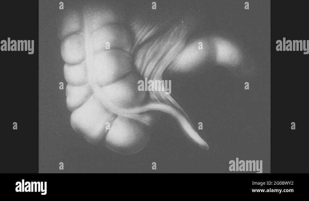 Appendix cross section Stock Videos & Footage - HD and 4K Video Clips ...